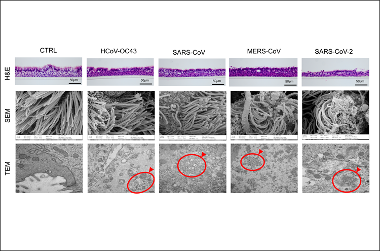 인공장기로 ‘코로나바이러스’ 감염 전략 밝혔다